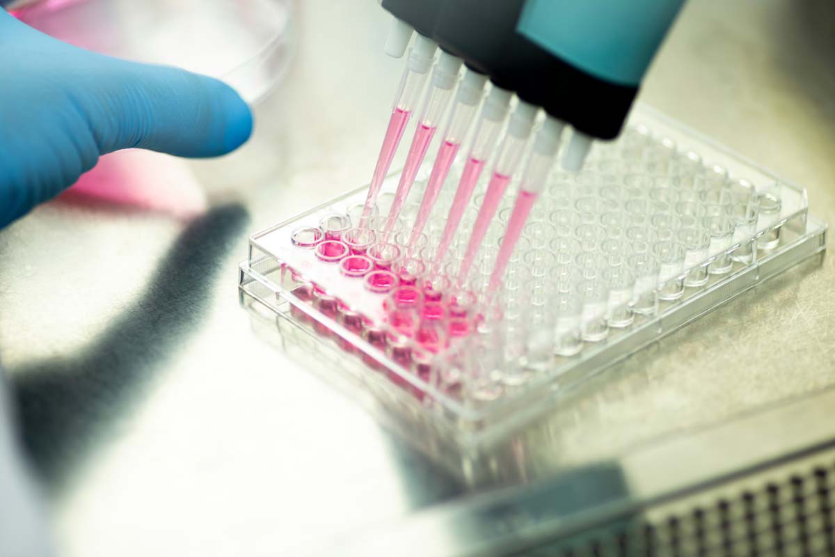 Toxic fabrics in Shein’s clothes: what are the materials to avoid ...